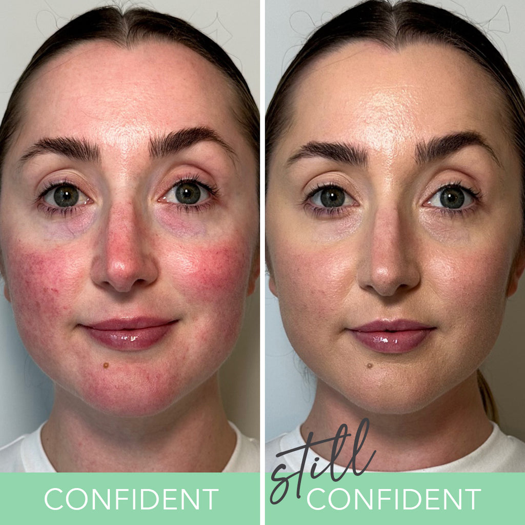 Color Correcting Green Cream – Doll 10 Beauty