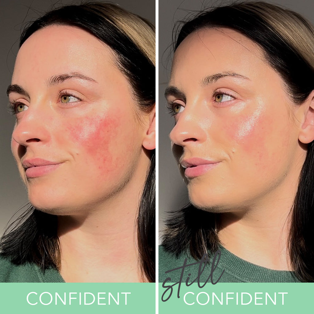 Color Correcting Green Cream – Doll 10 Beauty